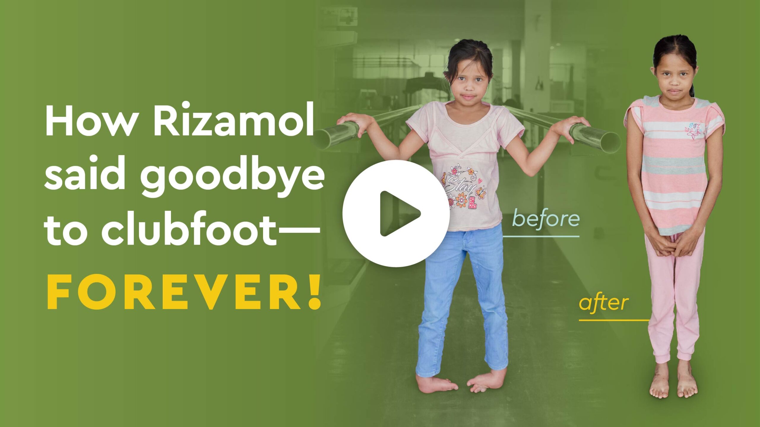 Clubfoot Kept Rizamol from School—After Surgery, She’s Back! - CURE