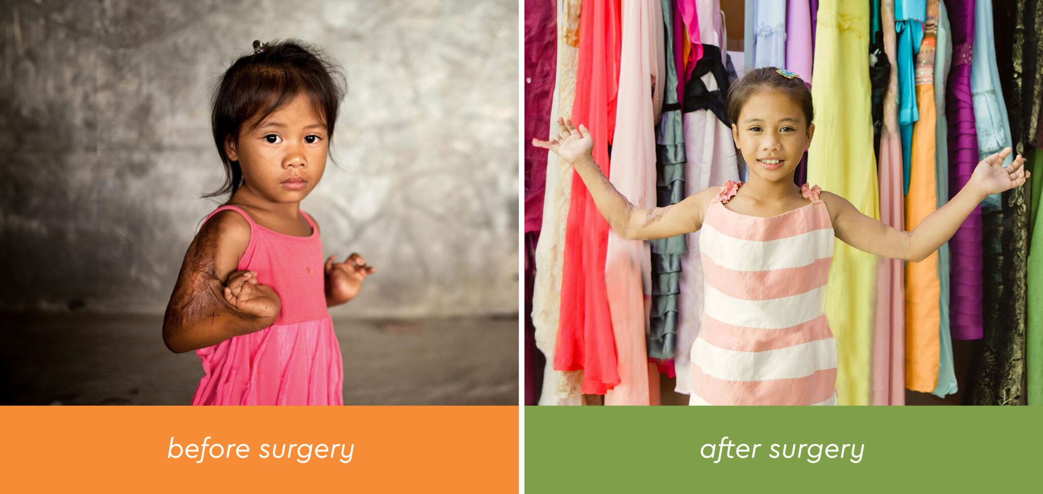 Surgery Healed her Arms. Freedom Restored Her Spirit - CURE