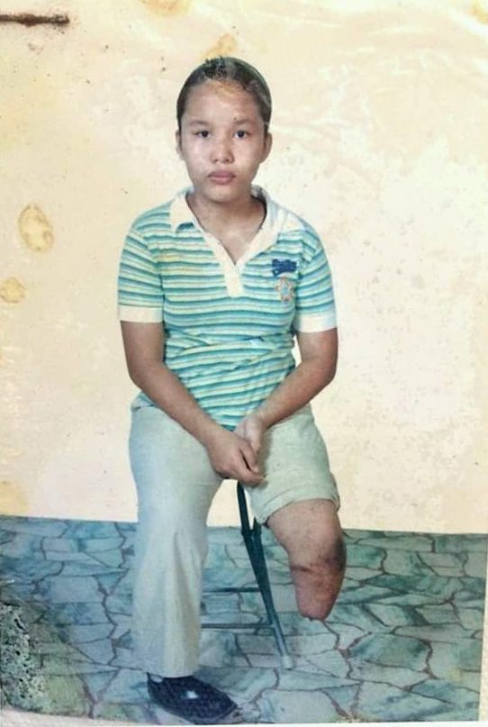 Your Ability is Stronger than your Disability - CURE