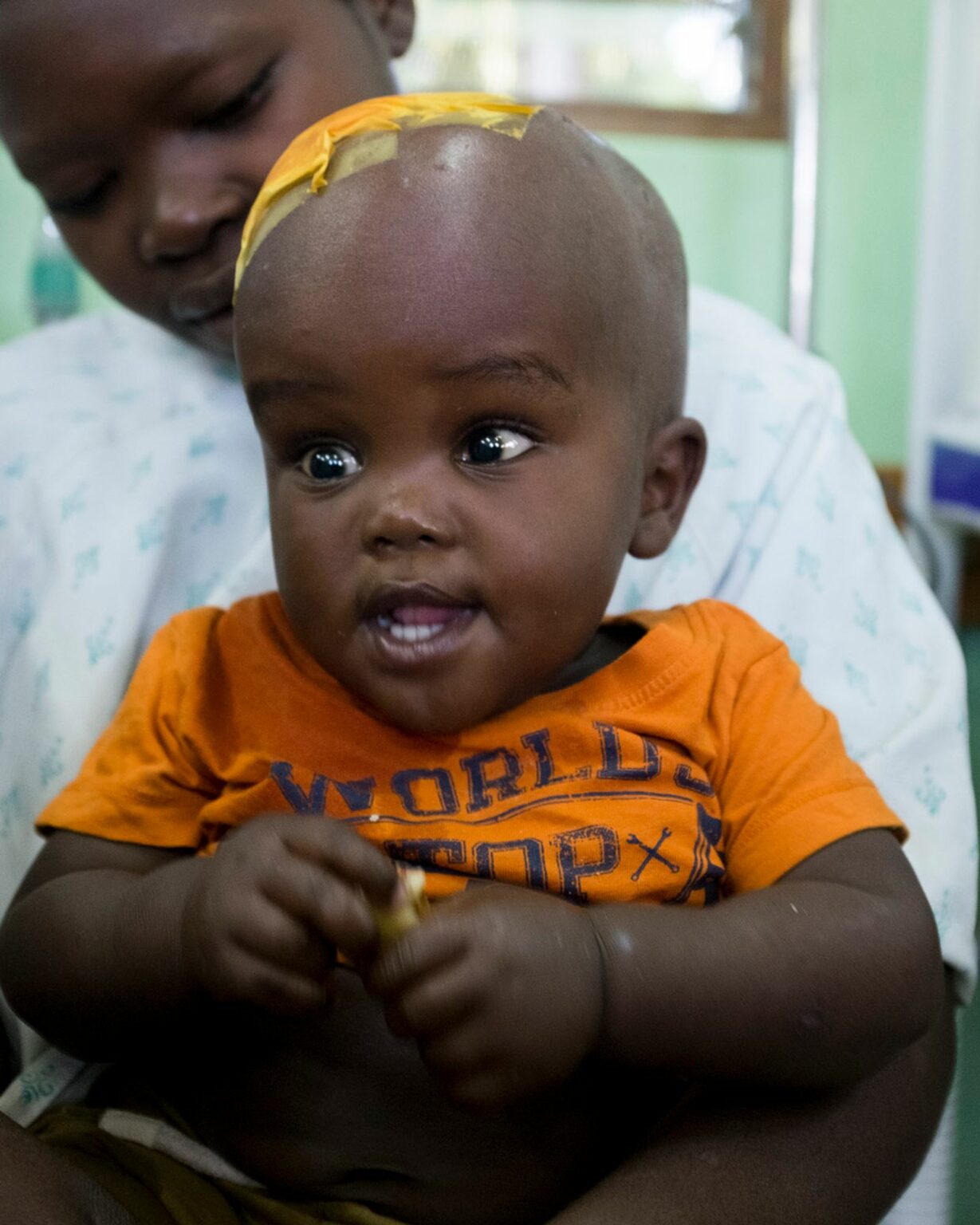 Hydrocephalus - CURE