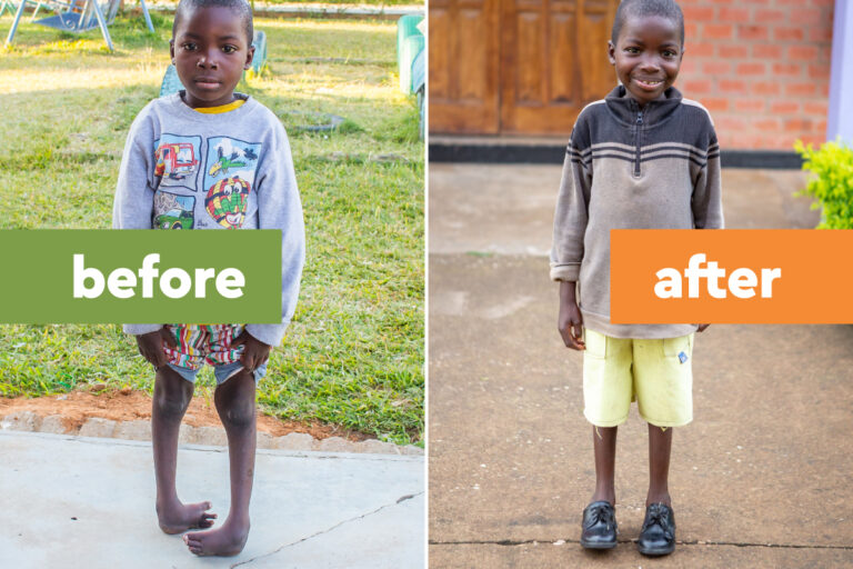 CURE International | Help Kids Heal