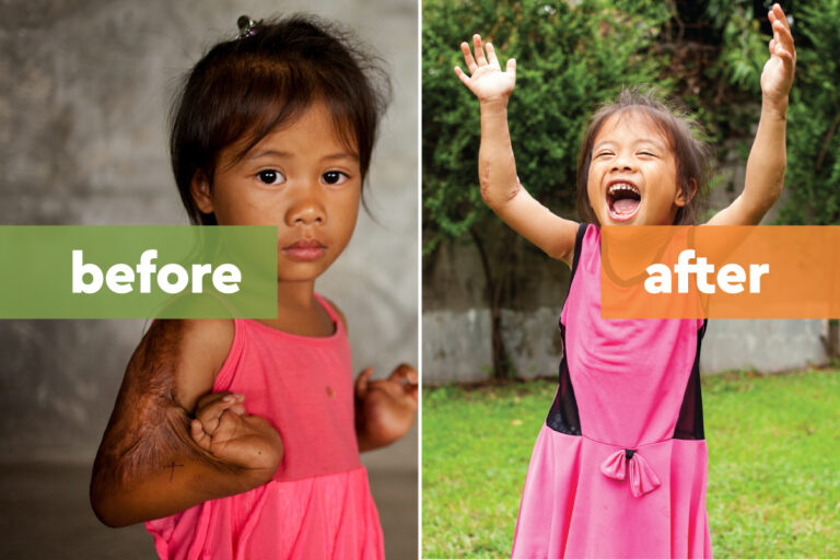 CURE International | Help Kids Heal