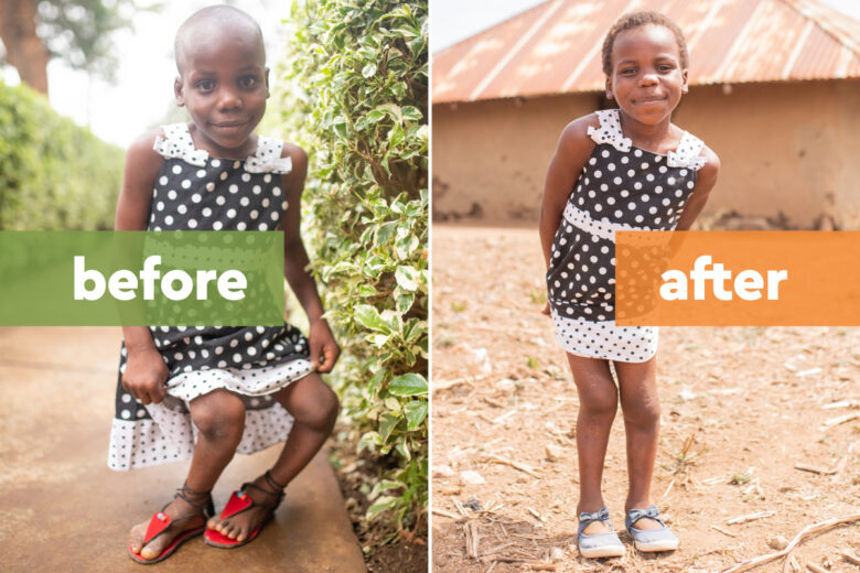 CURE International | Help Kids Heal