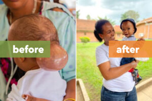 CURE International | Help Kids Heal