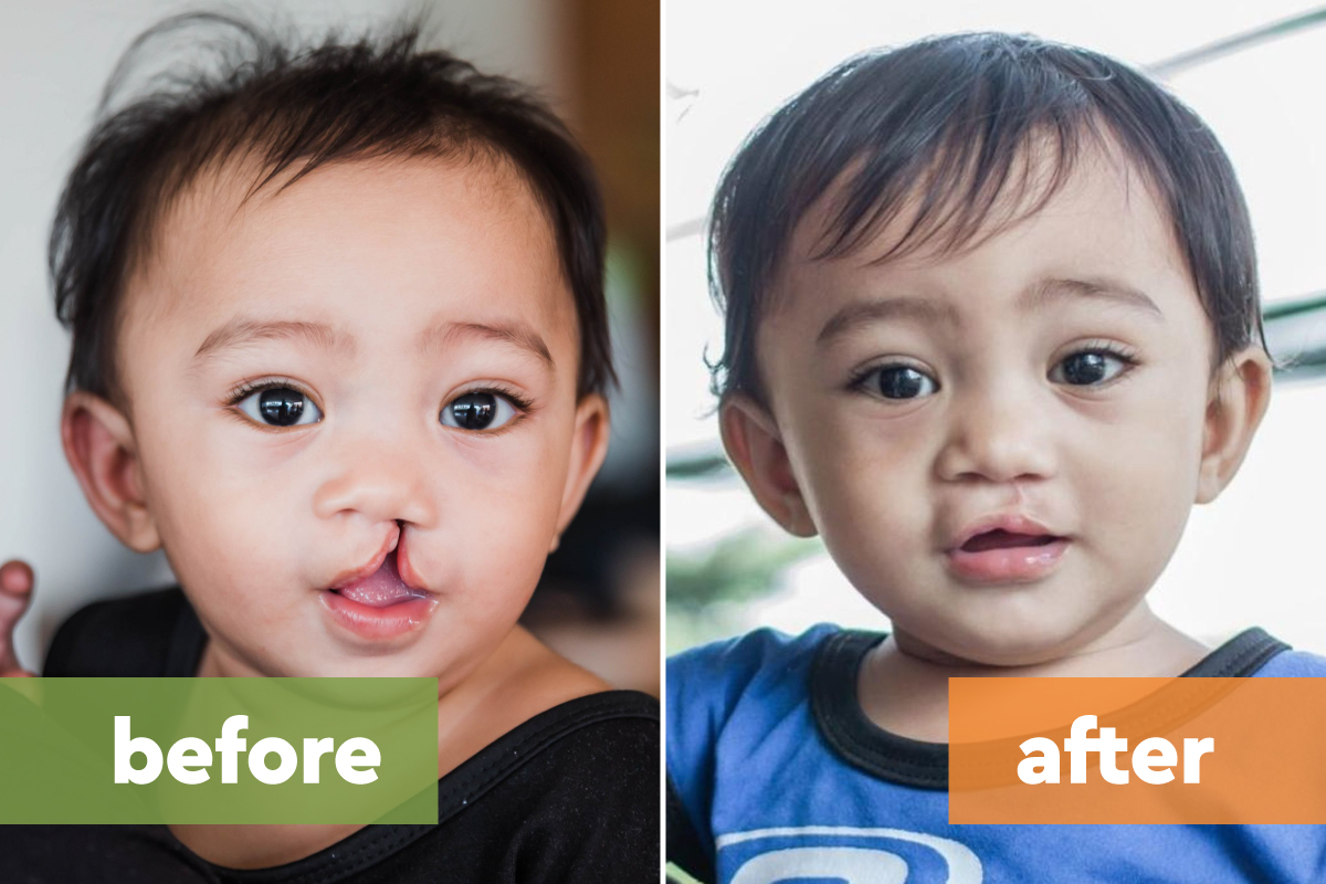 CURE International | Help Kids Heal