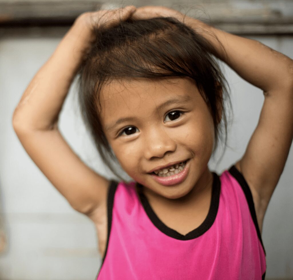 Burn Contractures - CURE