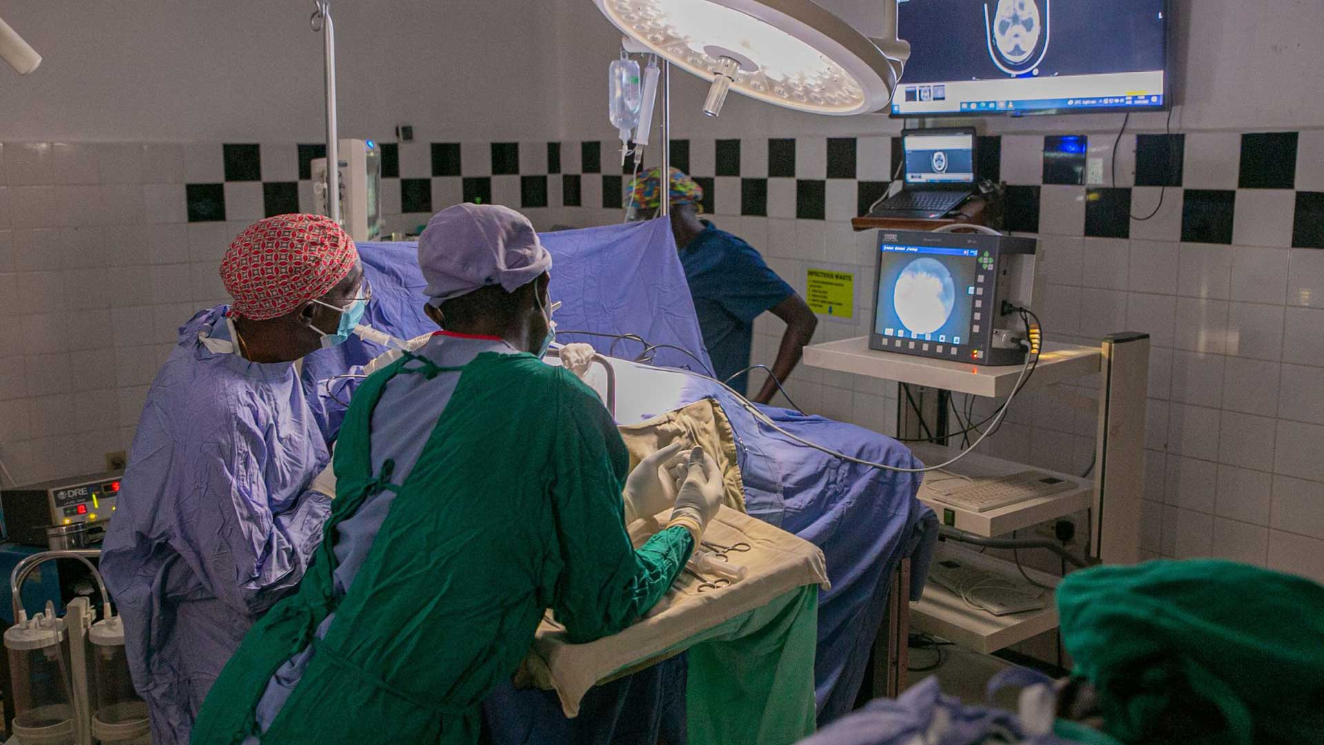 Hydrocephalus associated with neural tube defects: characteristics, management, and outcome in ...