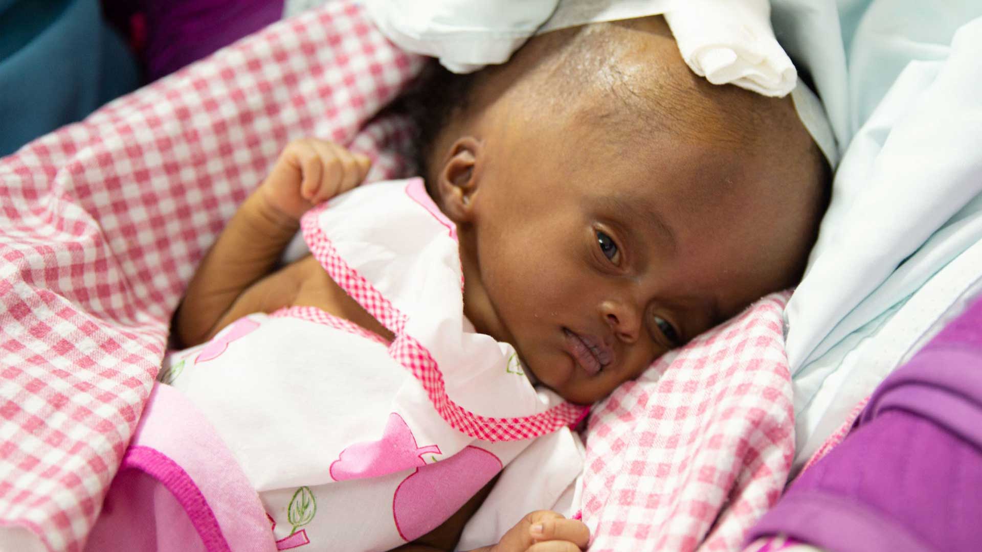 Five-year survival and outcome of treatment for postinfectious ...