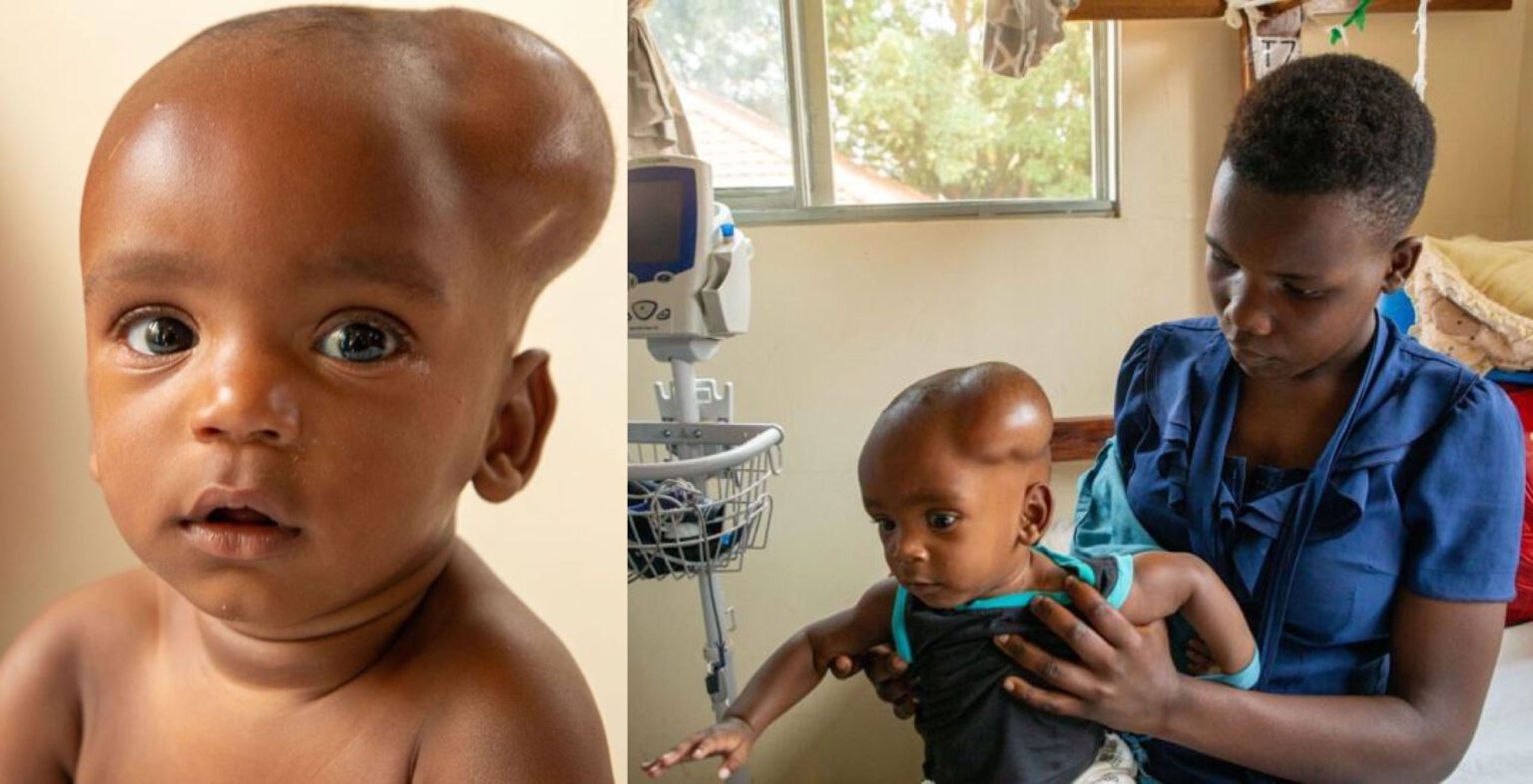 New Surgical Center Breaks Ground at CURE Uganda - CURE