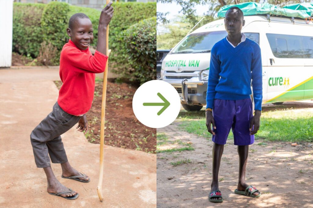 CURE International - Help Kids Heal