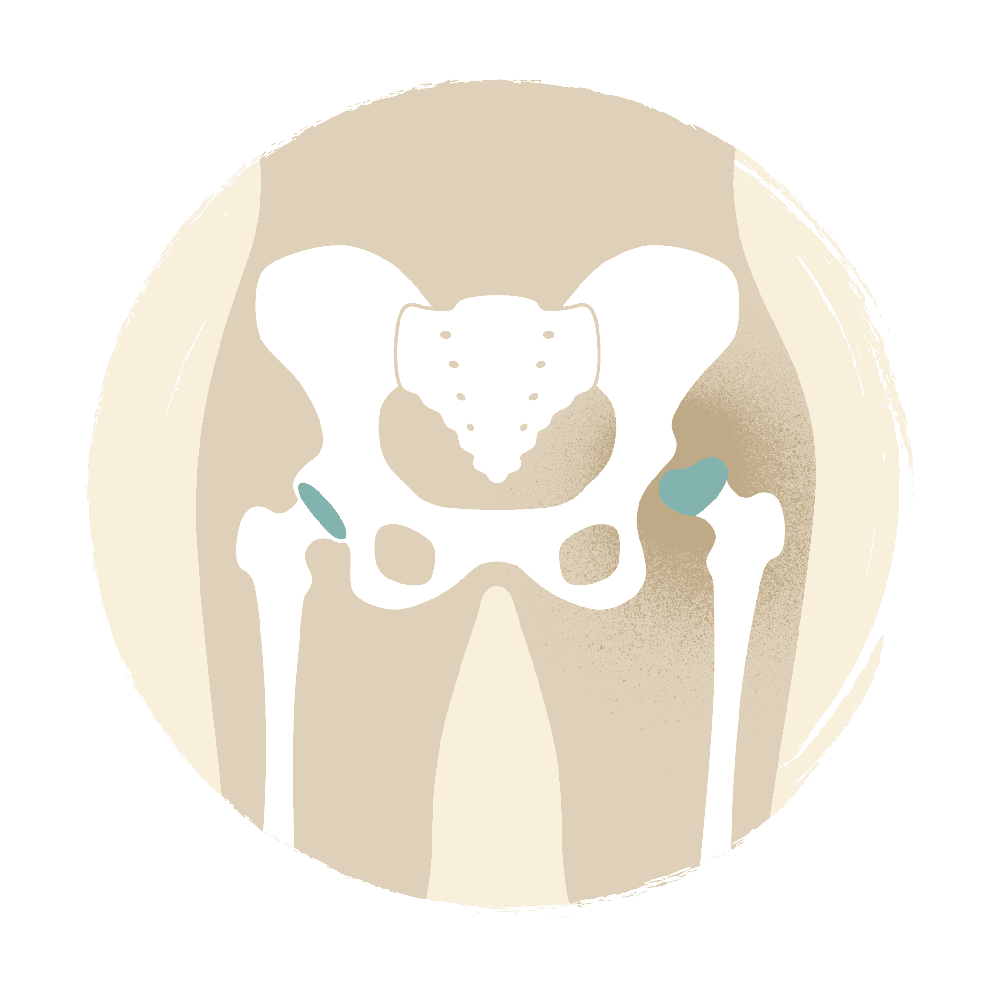 Hip Dysplasia - CURE