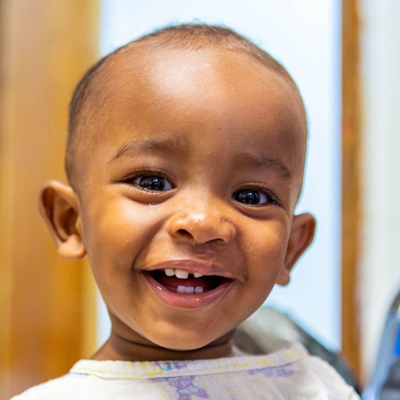 Cleft Lip Repair Changes Everything—Ask Kidus! - CURE